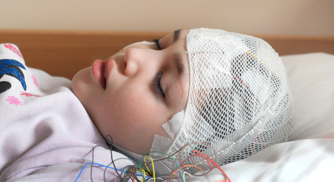 Epilepsy in Children: Diagnosis and Understanding the Causes, Types and ...