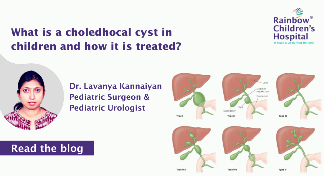 Choledochal Cyst: Choledochal Cyst Types and Choledochal Cyst Treatment