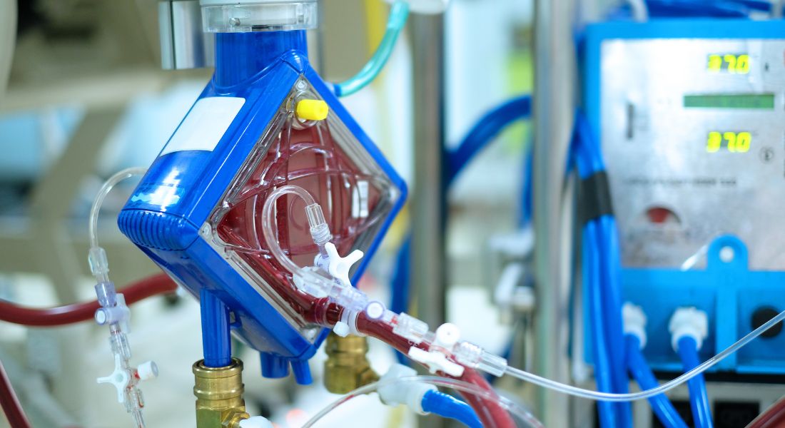 What is Pediatric ECMO Treatment and Why Do Some Children Need It?